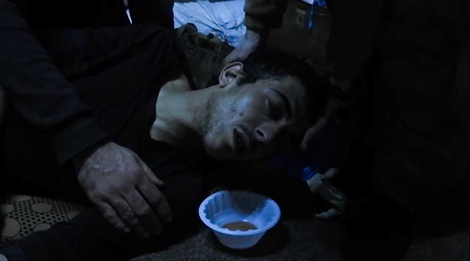 Imágenes de dos guerrilleros expuestos a armas químicas - La OPAQ sigue denegando la ...